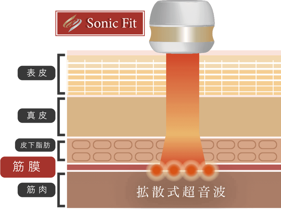 ソニックフィット(SonicFit)は何回くらい施術を受けると効果がわかる？ - SHIROKANE